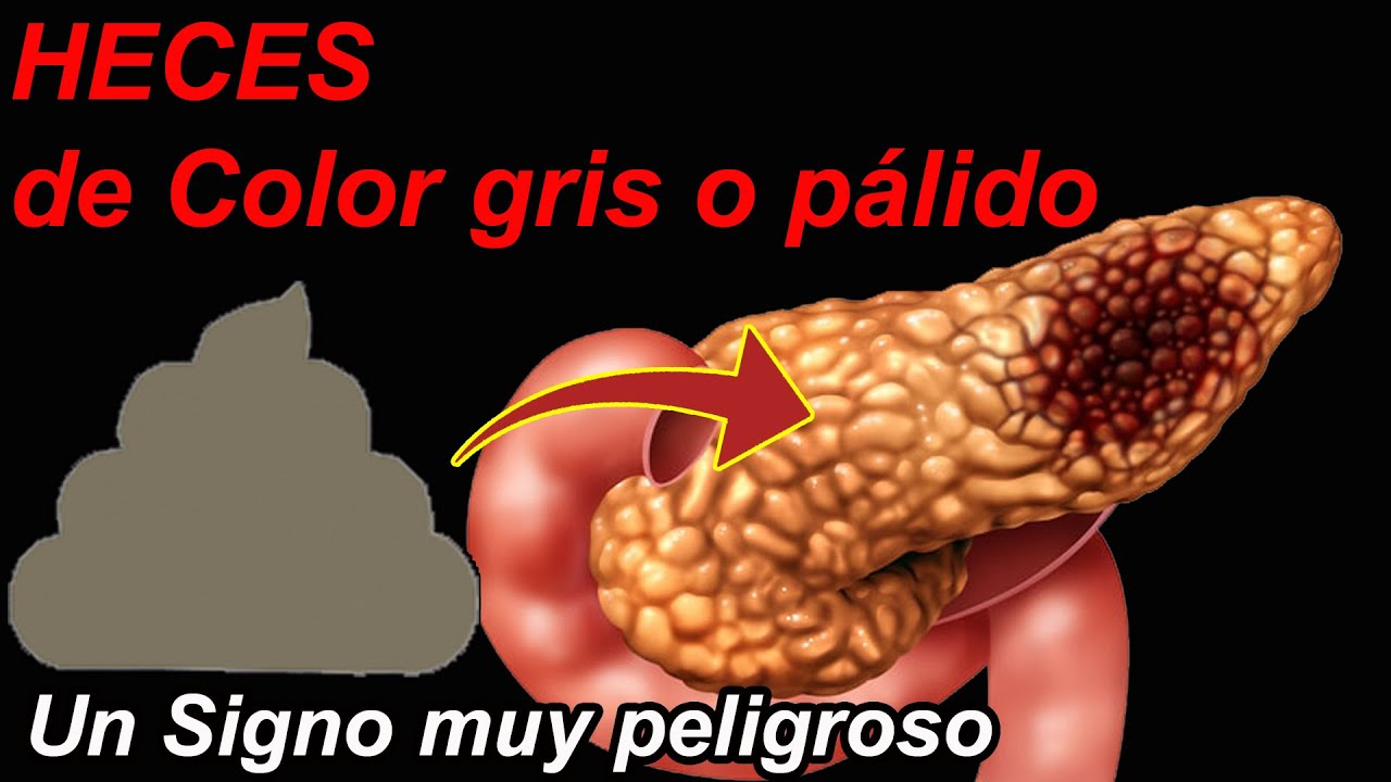 Si tus HECES son de ESTE COLOR, es muy posible que tengas un Páncreas ...