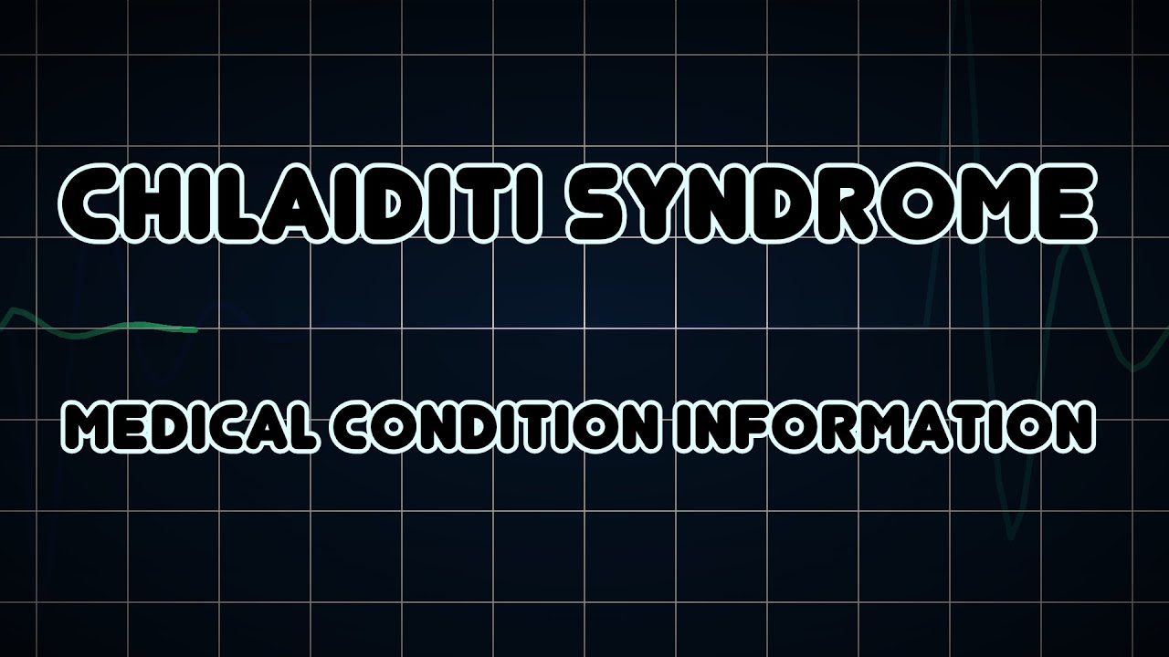 Chilaiditi syndrome (Medical Condition) - YouTube