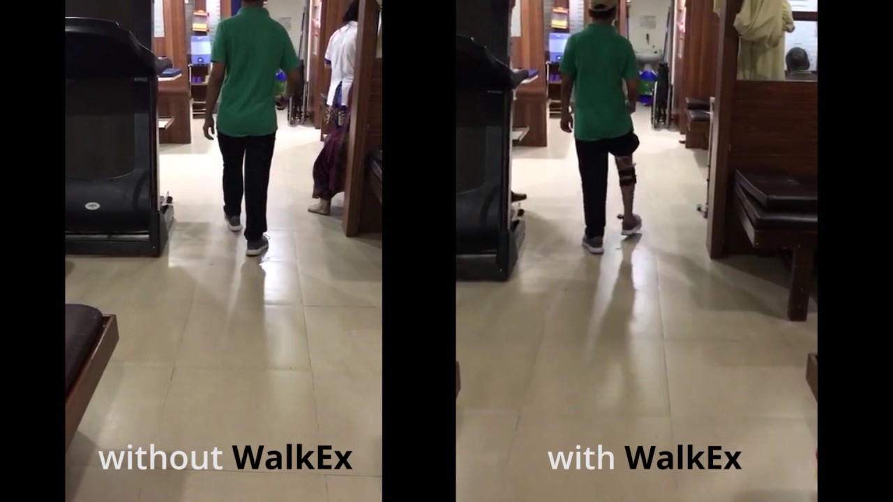 Walkex FES Functional Electrical Stimulation treats foot drop - YouTube