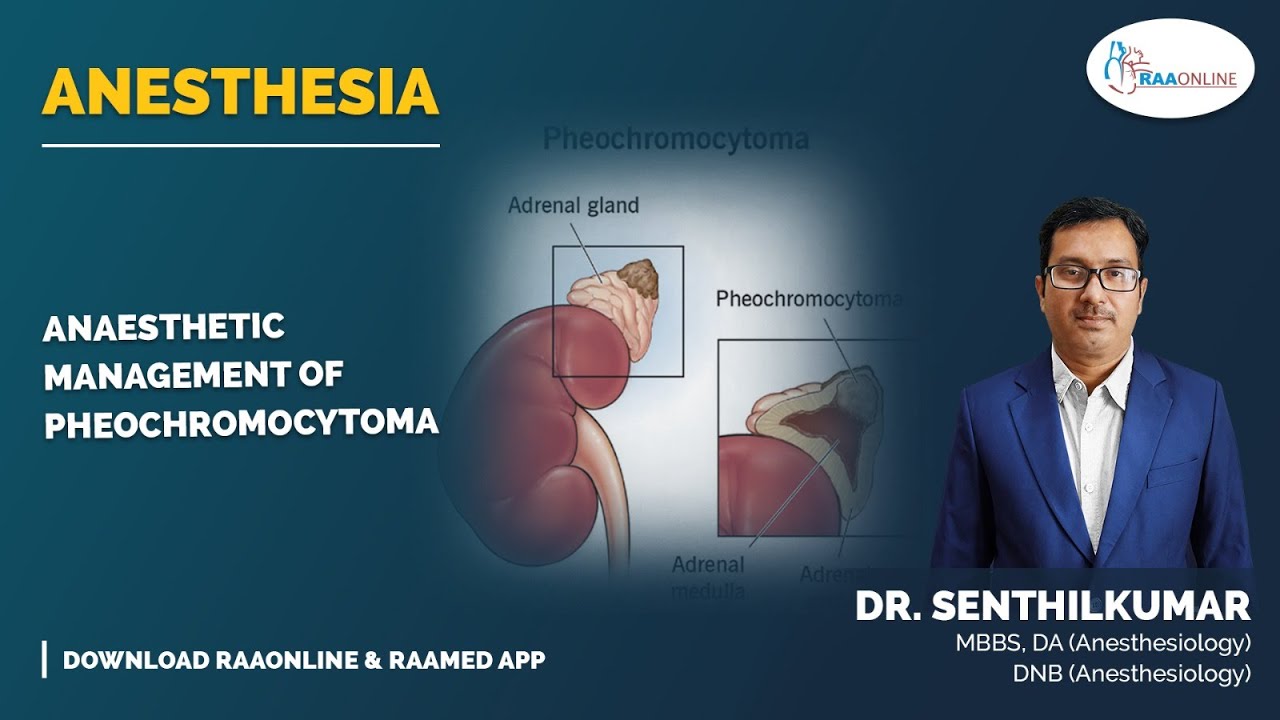 Anesthesia | Anaesthetic management of pheochromocytoma | Raaonline ...