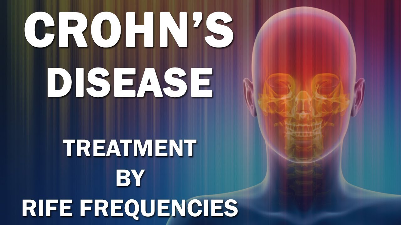 Crohn's Disease - RIFE Frequencies Treatment - Energy & Quantum ...