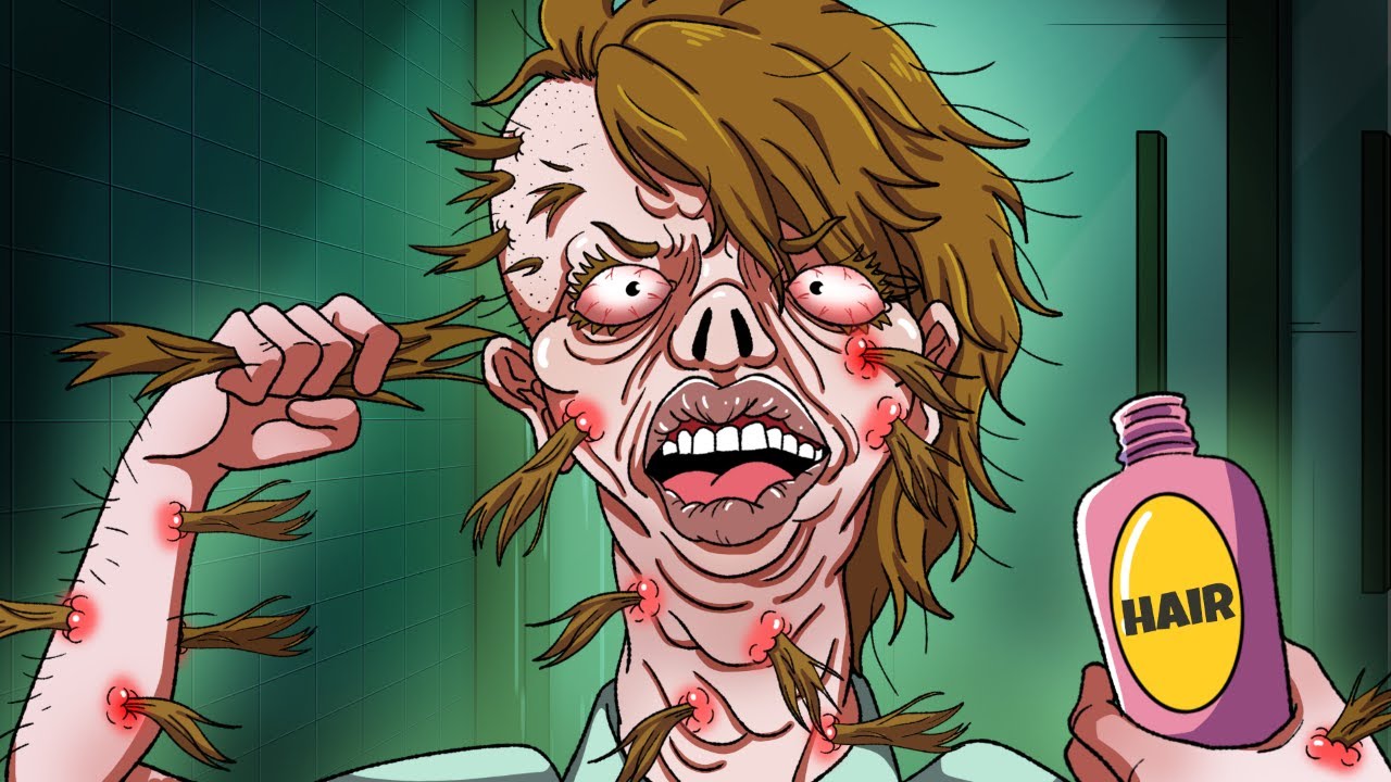 HAIR GROWTH GONE WRONG - Bald Man's Horror Story Animated - YouTube