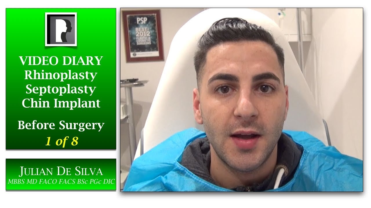 Male Rhinoplasty, Septoplasty & Chin Implant Video Diary –Day Before ...