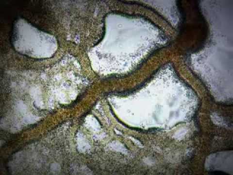 Slime Mold- Light Microscopy USYD - YouTube