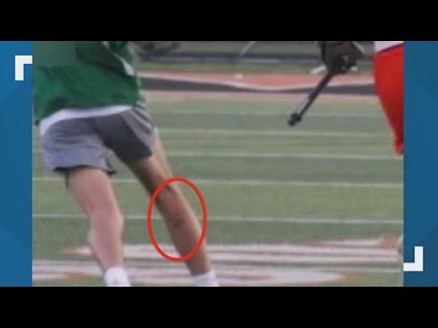 Student athlete seen with swastika on leg in Ohio: What school ...