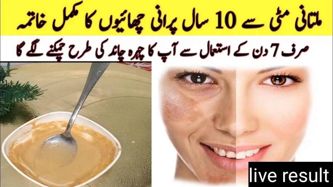 Multani Mitti Face Pack For Every Skin Type/Permanent Sun Tan Removal ...