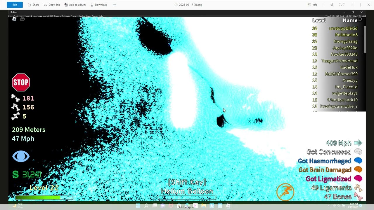 I got Ligmatized in broken bones - YouTube