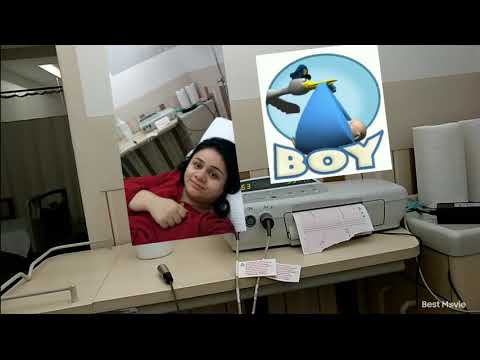 NST #Kalp carpıntısı#Kalp sesi #Ürək səsi Balamın ürək ❤🐣döyüntüsü #nst