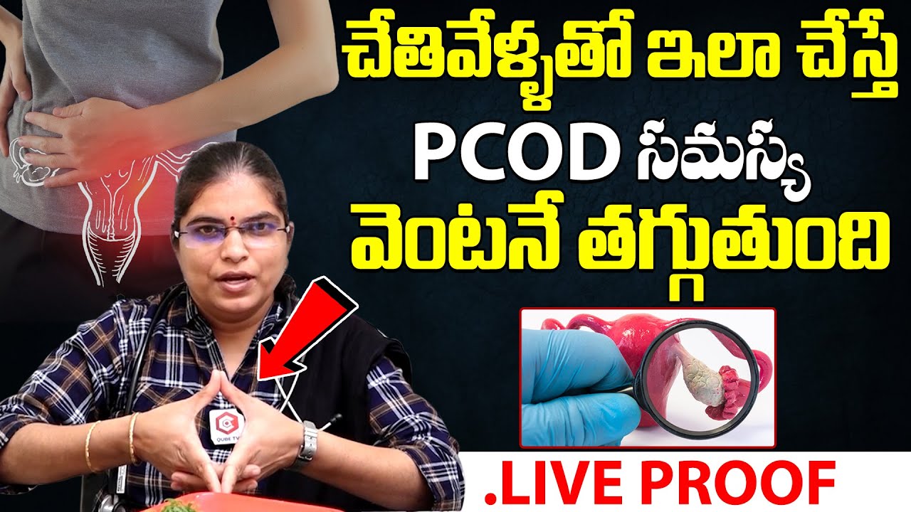 LIVE PROOF : How to Cure PCOD Naturally ? | PCOD At Home Remedies And ...