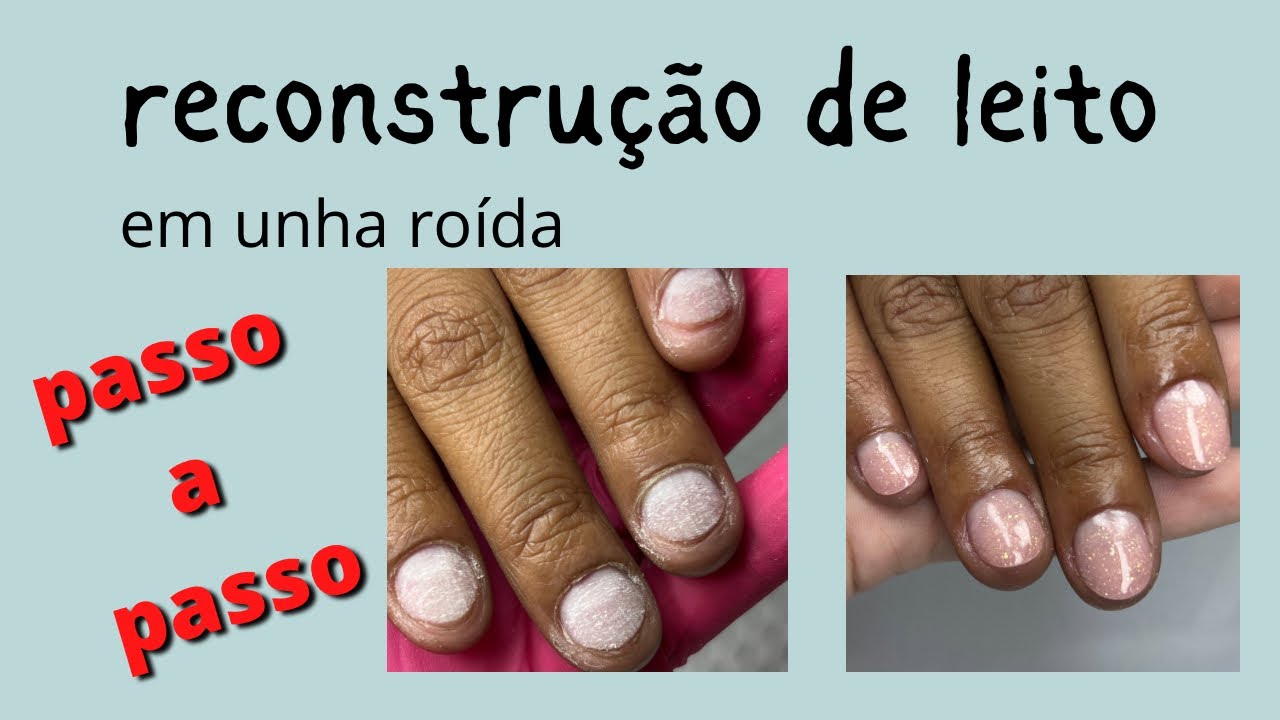 Unha roída - YouTube