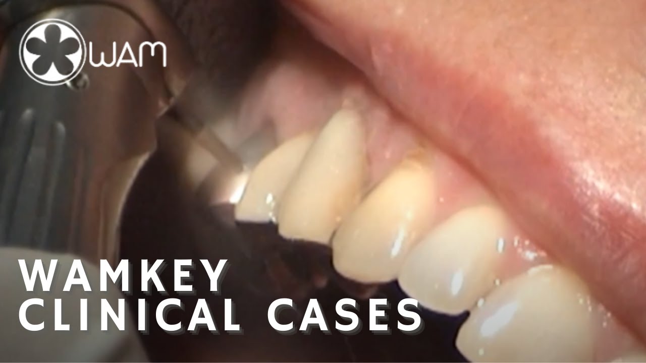 WAMkey cas cliniques commentés - YouTube