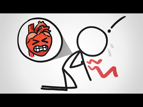 Why Do Heart Attacks Cause *Arm* Pain?