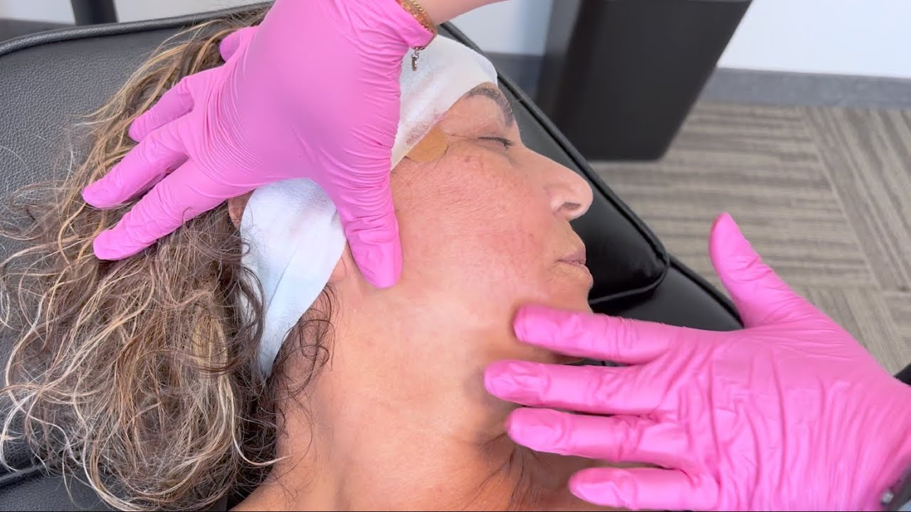 Another Happy Lift Patient with VSoft Lifting Threads - YouTube