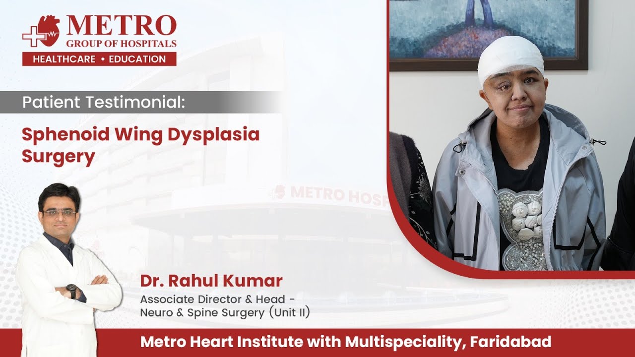 Successful Sphenoid Wing Dysplasia Surgery | Patient Testimonial ...