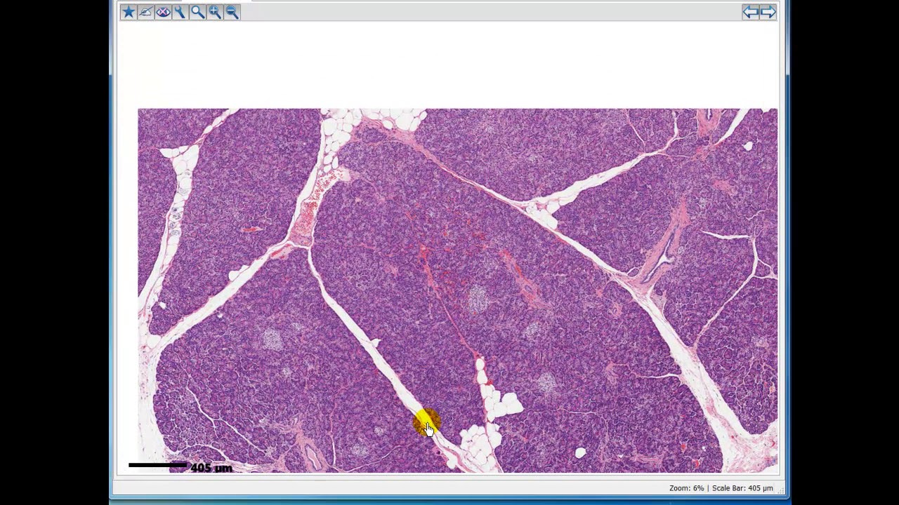 Reading a Pancreas Specimen - YouTube