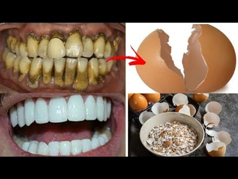 In just 1 minute, transform your yellow teeth into shiny white teeth ...