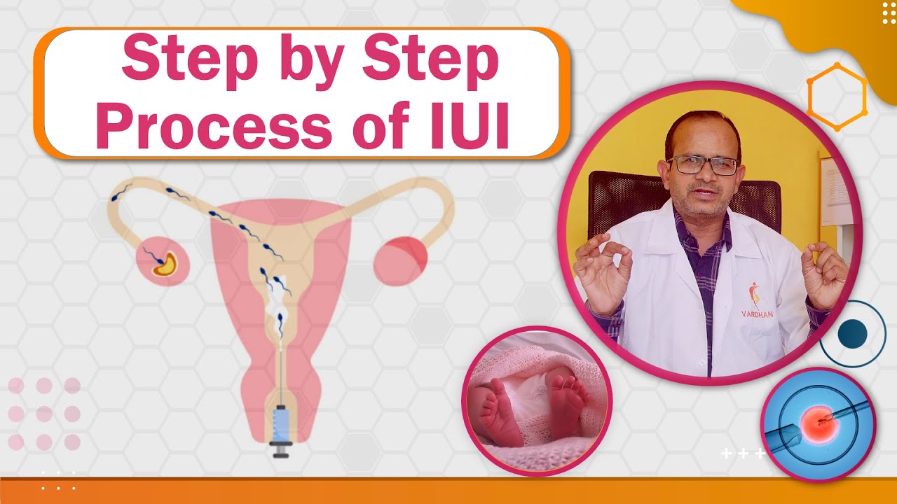 Step by Step Process of IUI | Information about IUI | Success and ...