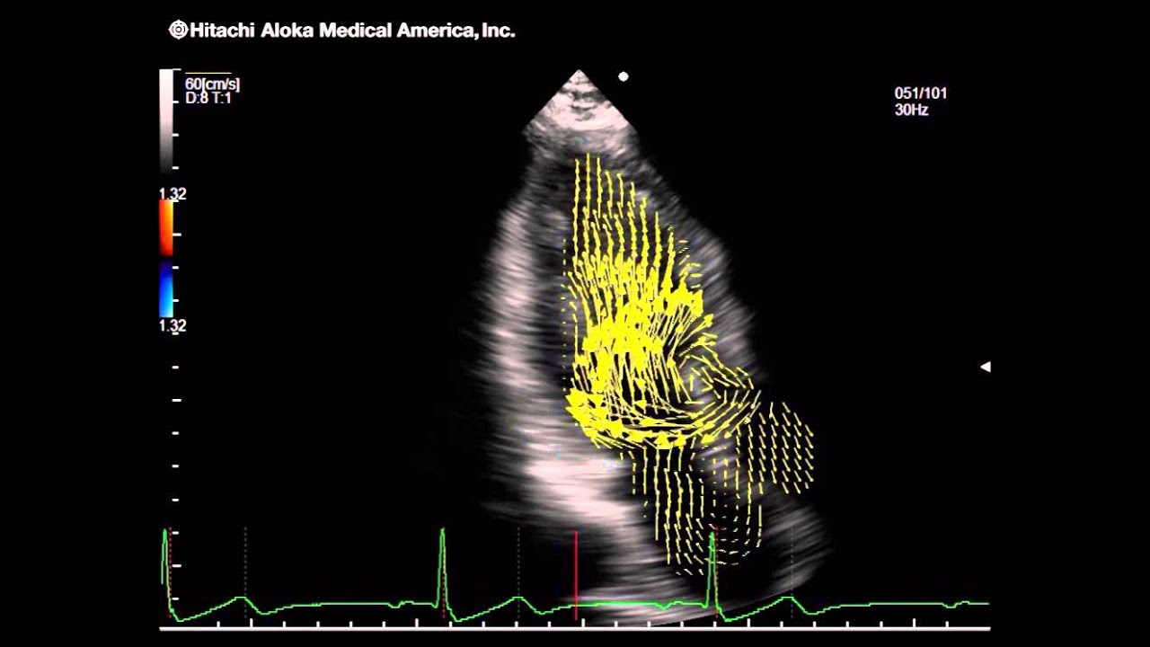 A70 Vector Flow Mapping - YouTube
