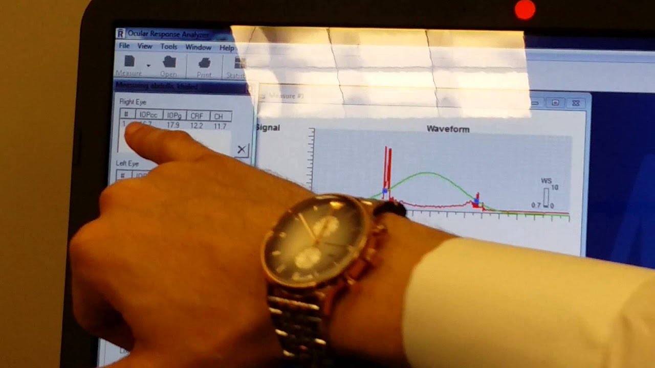 شرح جهاز (Ocular Response Analyzer (ORA - YouTube