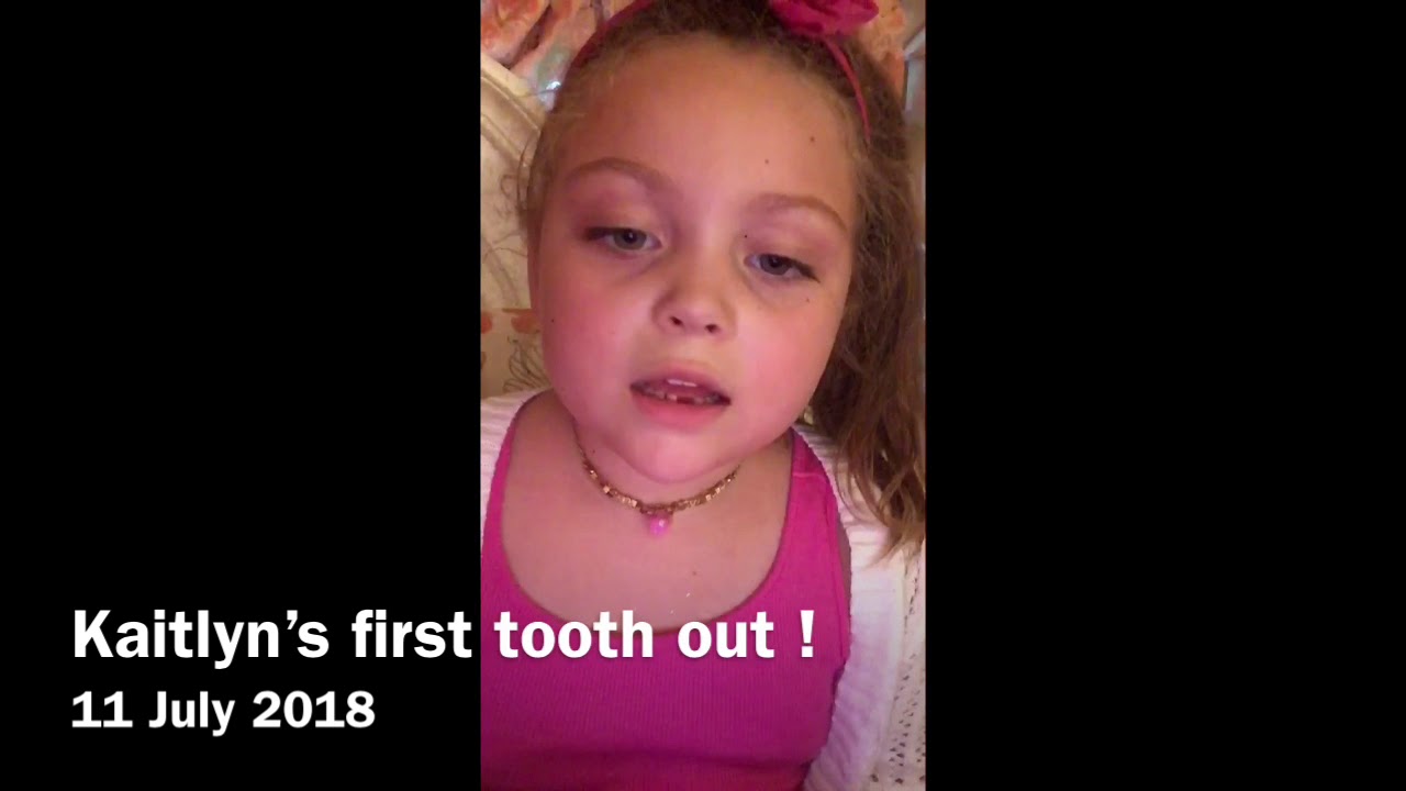Kaitlyn’s first tooth out ! - YouTube