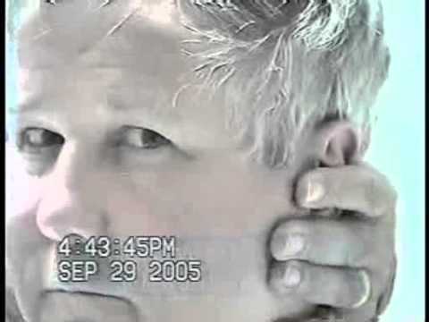 Abnormal Head Impulse Test - YouTube