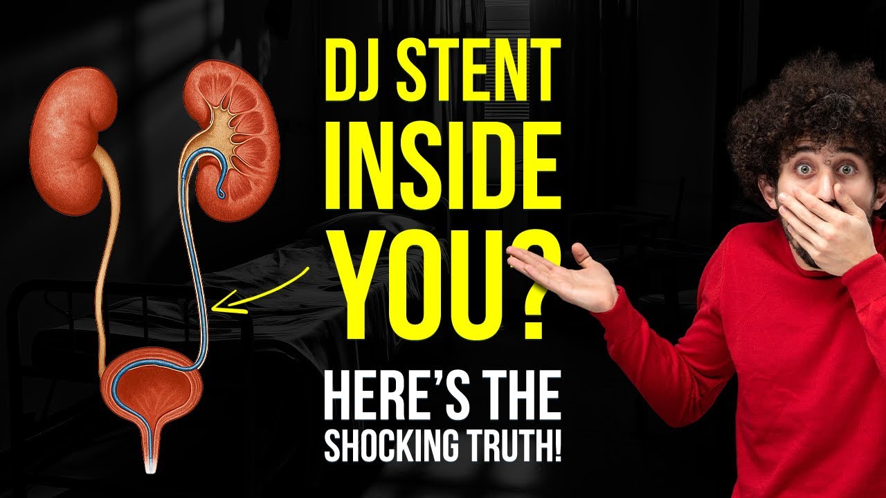 “What Is a DJ Stent? Purpose, Side Effects & Removal | Must-Know Info ...