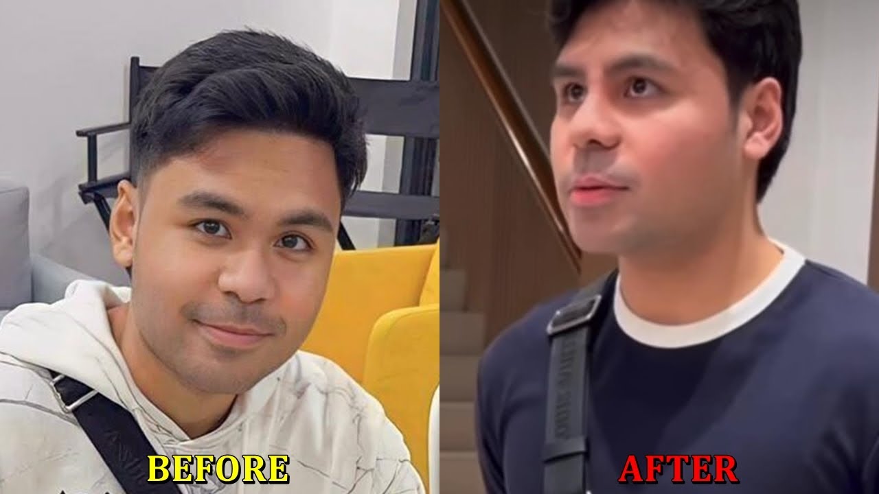 Michael Pacquiao, Nagpa-Retoke nga ba ng Ilong? - YouTube