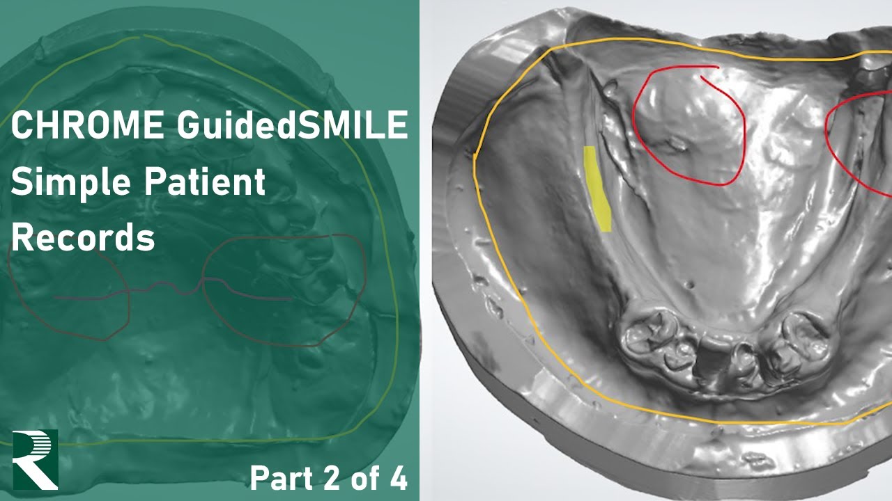 CHROME GuidedSMILE: Simple Patient Records Webinar (Part 2 of 4) - YouTube