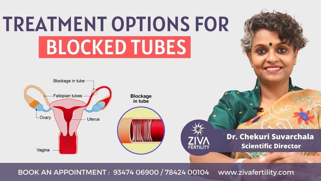 Treatment options for blocked fallopian tubes || Dr Chekuri Suvarchala ...