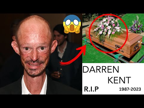 LAST WORDS: Darren kent Cause of Death? Game of Thrones Star, Dead at 39