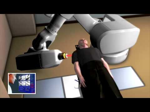CyberKnife - Full Treatment Clip - YouTube