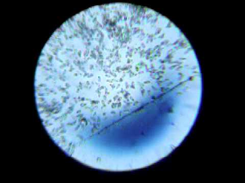 Observação de protozoários em microscópio óptico - YouTube