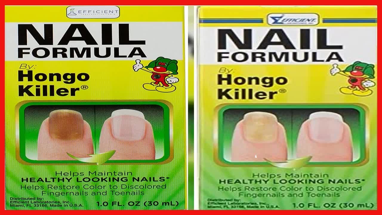 Hongo Killer Nail Formula, Improve the Appearance of Your Nails - YouTube