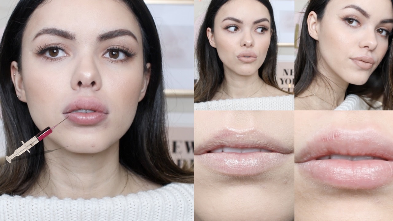 LABIOS GRUESOS EN 2 MINUTOS!! - YouTube