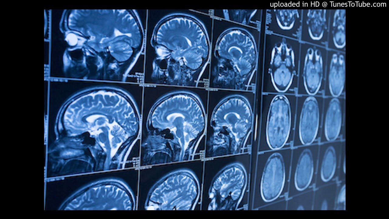 The development of medical imaging technology - YouTube