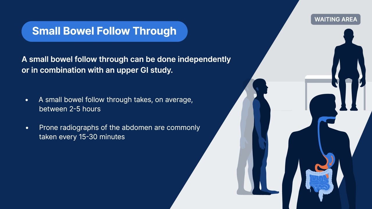 SBFT Radiology: What to Expect & How to Prepare in the US