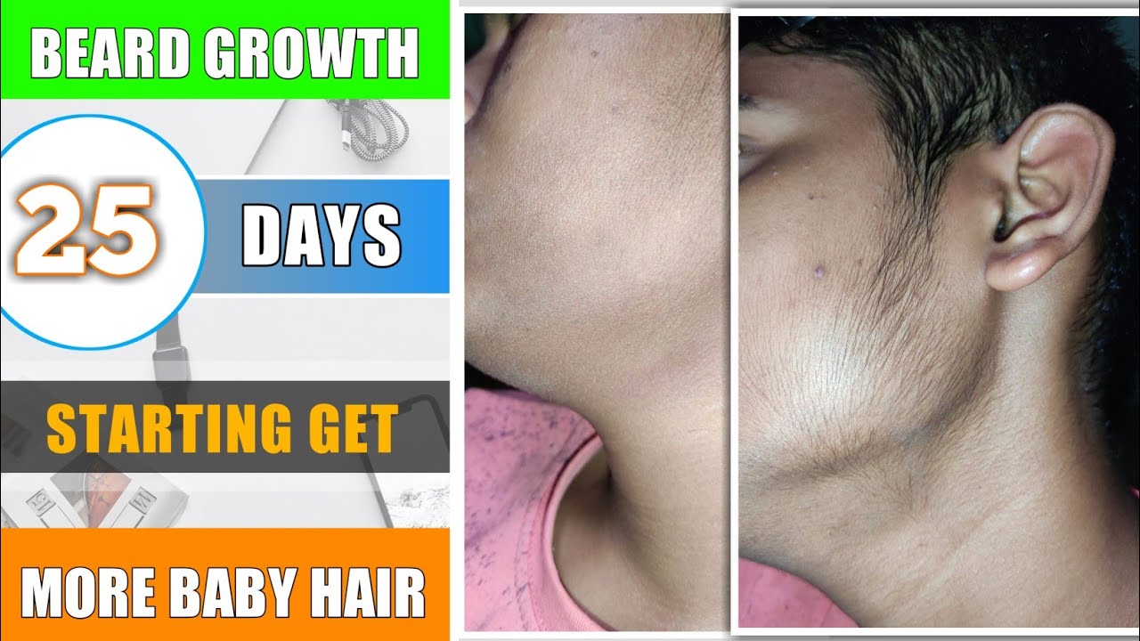 BEARD GROWTH ! Starting 25 days get more baby hair ! Dadhi kaise ugayen ...