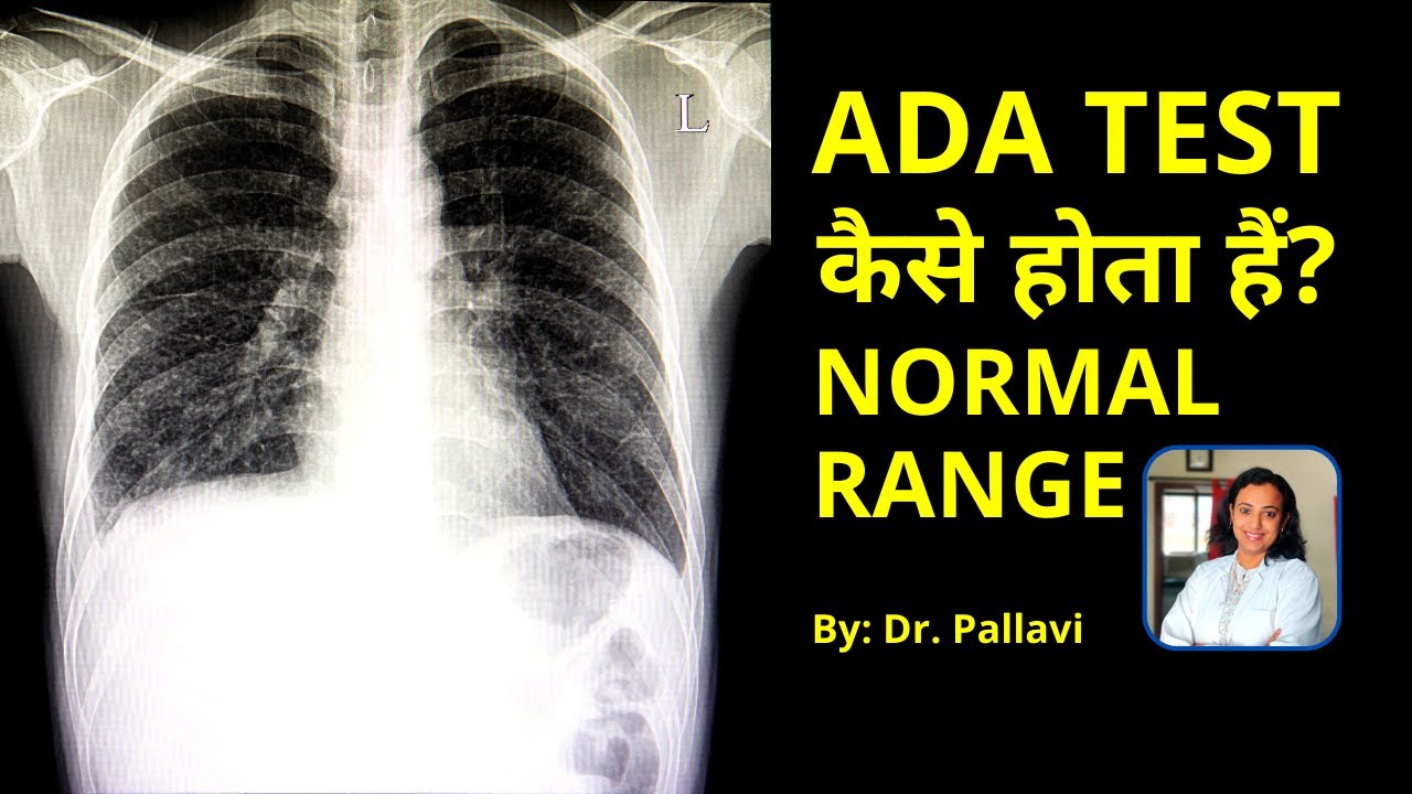 ADA Test for TB or Pleural Fluid in Hindi | Adenosine Deaminase Test ...
