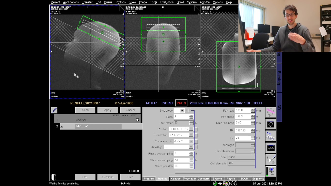 Tutorial on the 3rd order shim at scannexus' 7T scanner - YouTube