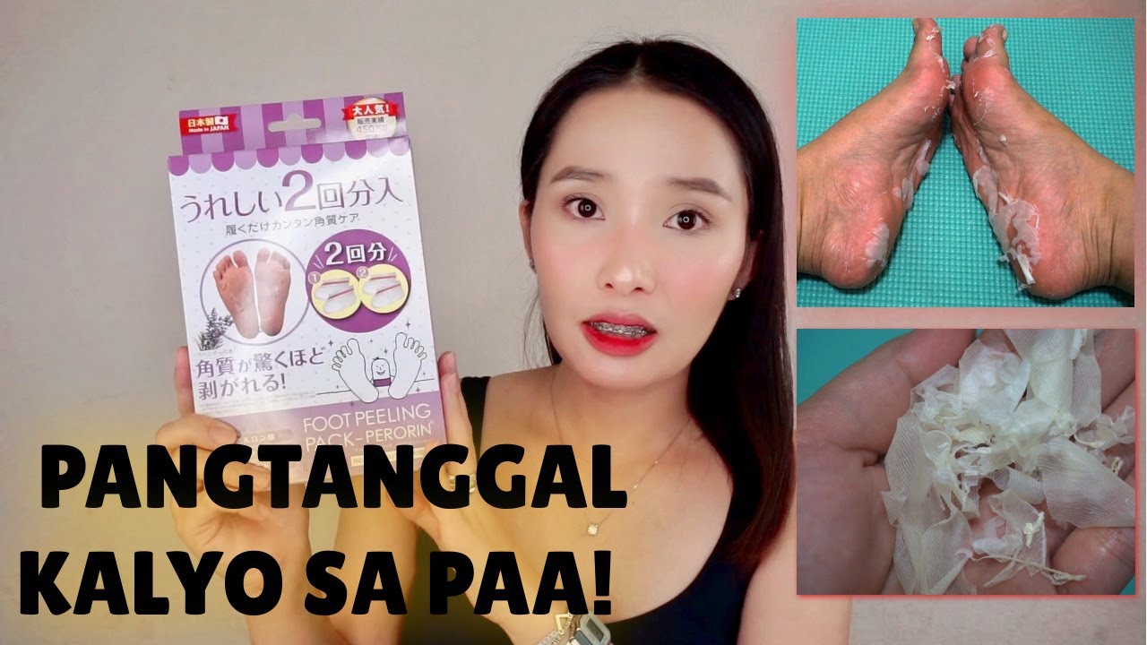 Legit! PANTANGGAL KALYO SA PAA! FOOT PEELING PACK PERORIN REVIEW | Galy ...