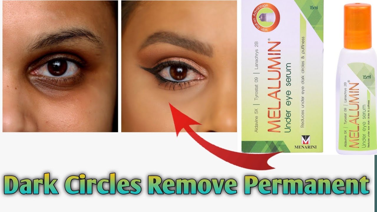 Dark Circle Remove!! Melalumin Under Eye Serum Uses In Hindi ! "DIGITAL ...