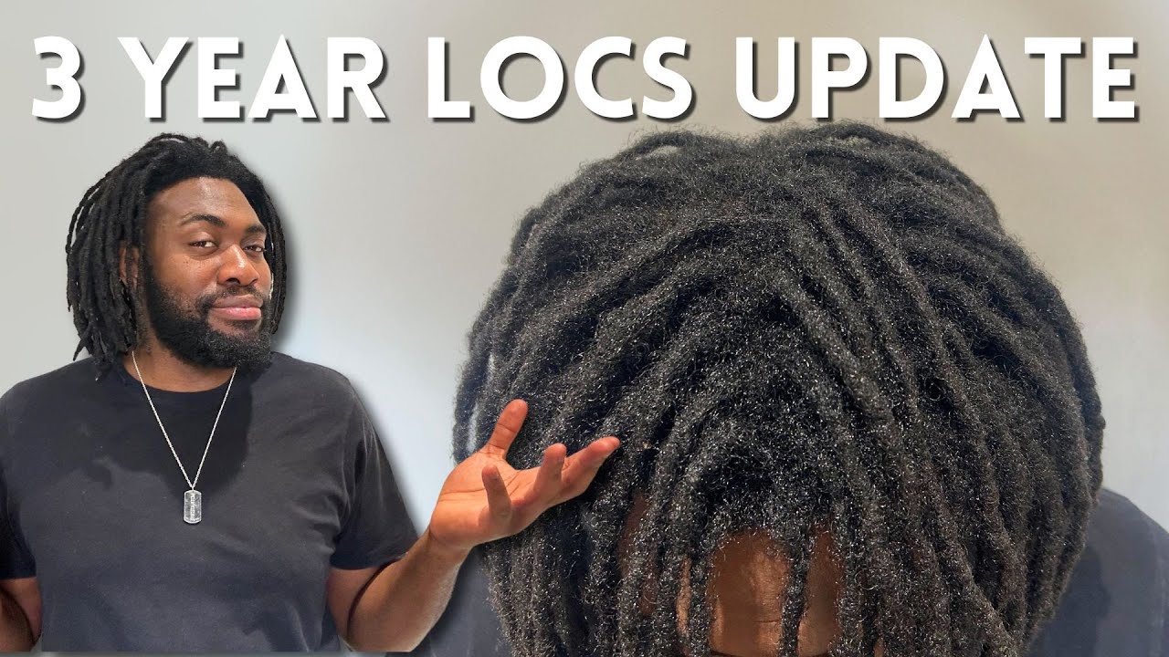 3 Year Dreadlocks Update | Locs Thinning & Traction alopecia | Life ...