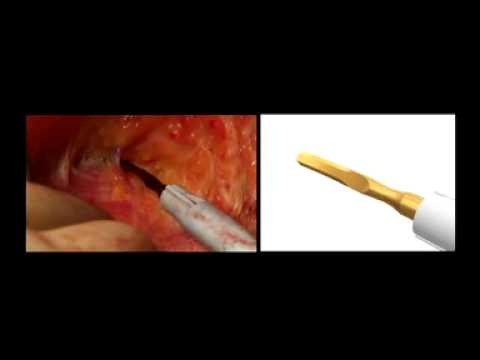 Harmonic Synergy Curved Blade - YouTube