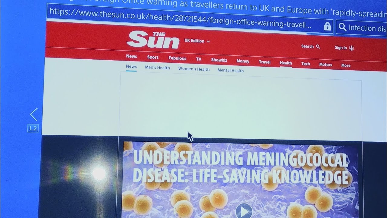 the sun is just found a new disease in the UK kells 1 in 10 in 24 hours ...