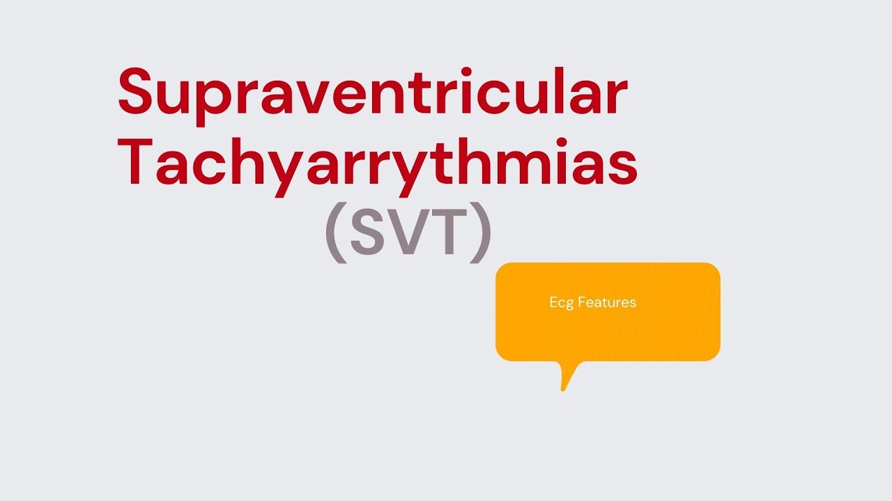 #Supraventricular Tachycardia (SVT): #Types and #ECG features - YouTube