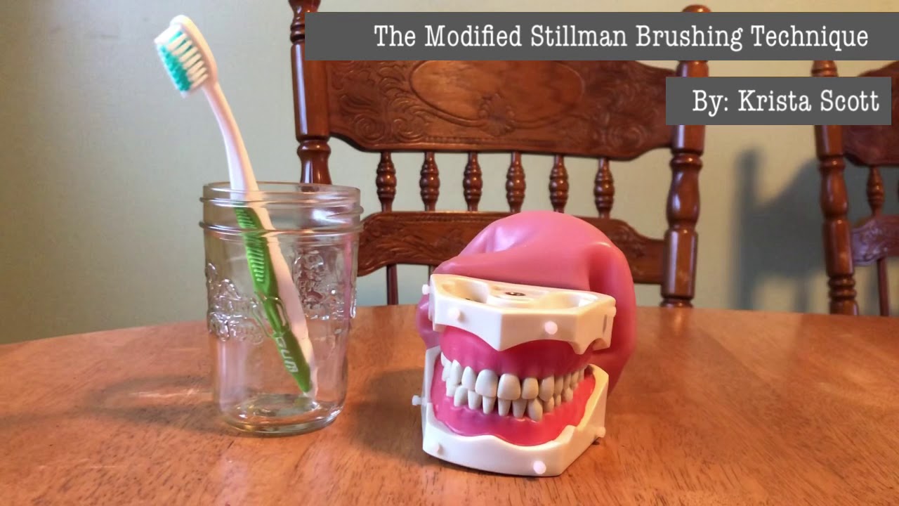 Modified Stillman - YouTube