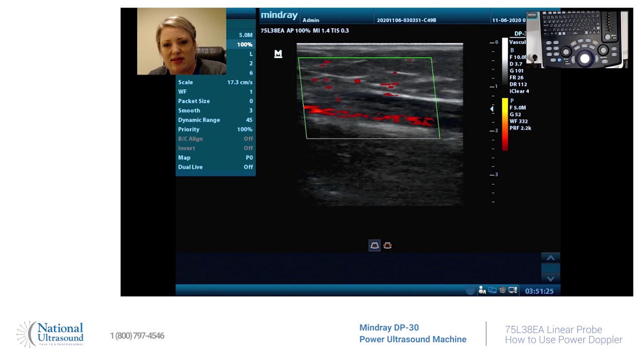 Mindray DP 30 with a 75L38E Video Training Demonstration on How to use ...