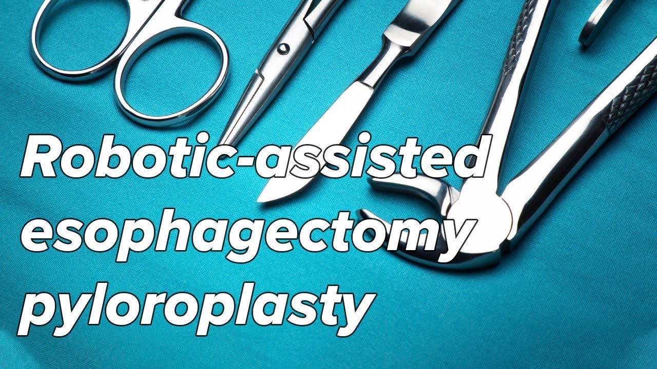 Robotic-assisted esophagectomy pyloroplasty | Gastric Outlet ...