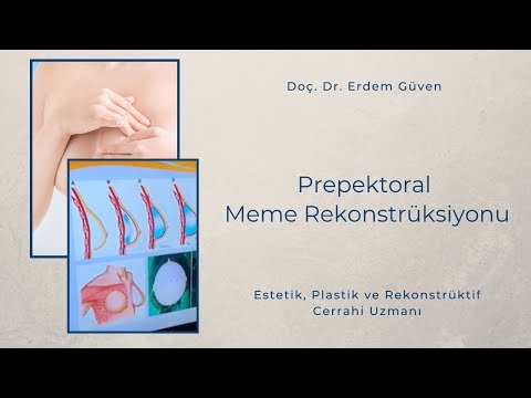 Prepektoral Meme Rekonstrüksiyonu⁣ | Meme Rekonstrüksiyonu | Doç. Dr. Erdem Güven
