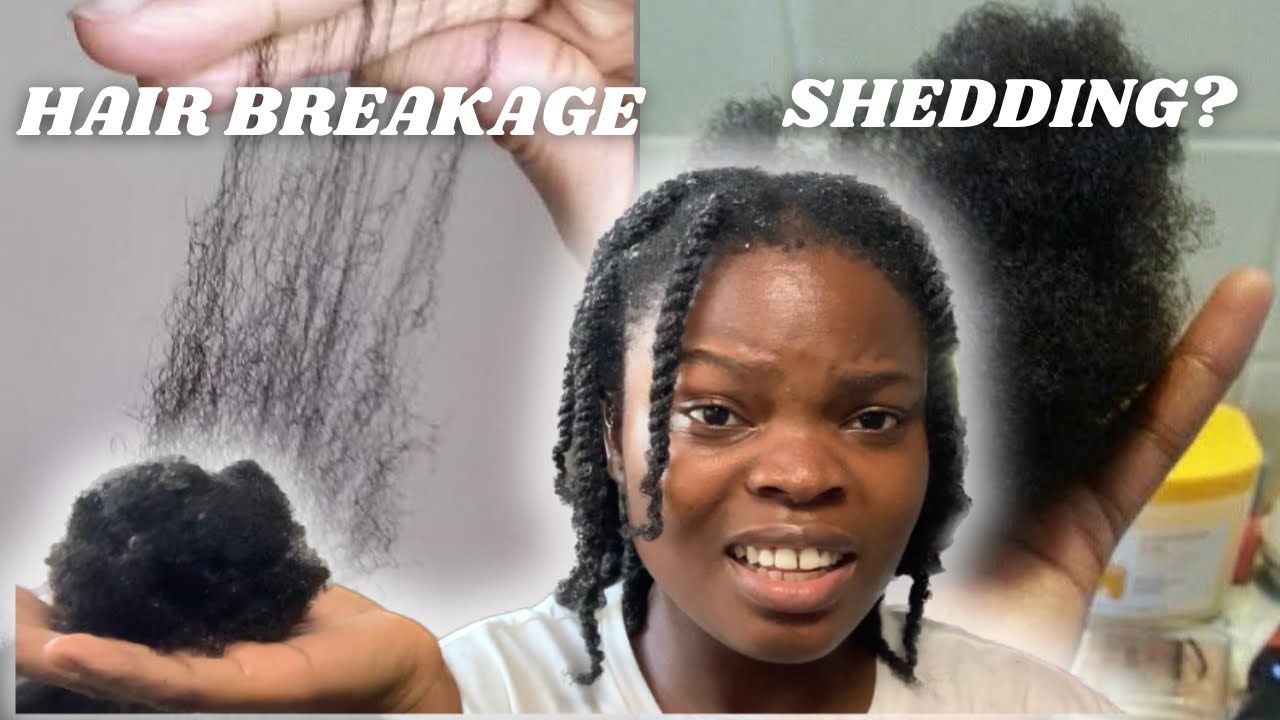 MY HAIR IS FALLING OFF! | HOW TO STOP & PREVENT HAIR LOSS AND HAIR ...